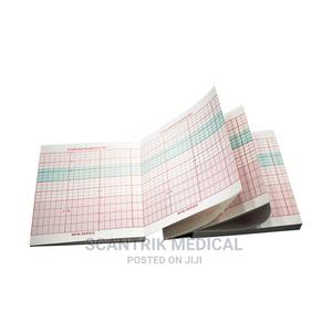 Thermosensitive ECG Thermal Paper in Yaba - Medical Equipment ...