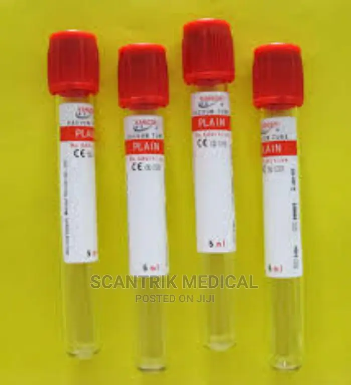 Plastic Blood Collection Tubes, Plain, for Laboratory in Yaba - Medical ...