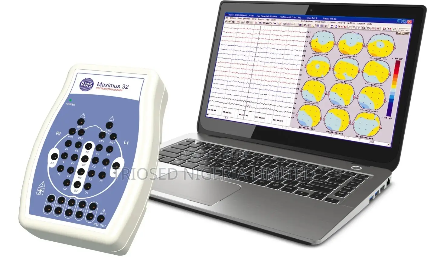 Maximus 24/32 Portable Eeg Machine in Ikeja - Medical Equipment ...