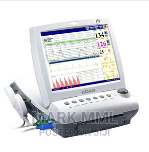 Edan F9 Express CTG Fetal Monitor in Ogudu - Medical Equipment ...