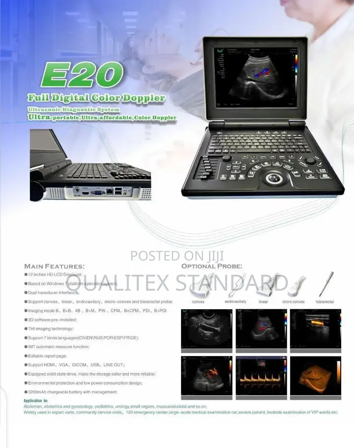 Full Digital Color Dopler Ultrasound Machine for sale - QUALITEX ...