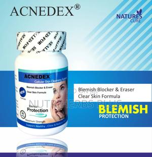 Acnedex: Powerful Treatment for Acne and Sunburn in Wuse 2 - Vitamins ...