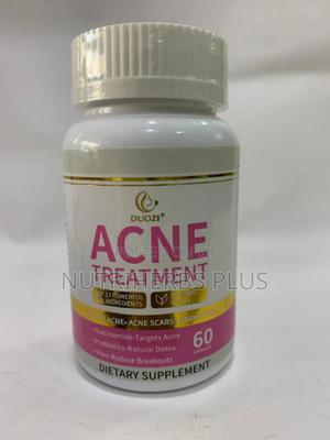 Get Rid of Acne and Pimples Permanently With Acne Capsules in Kubwa ...