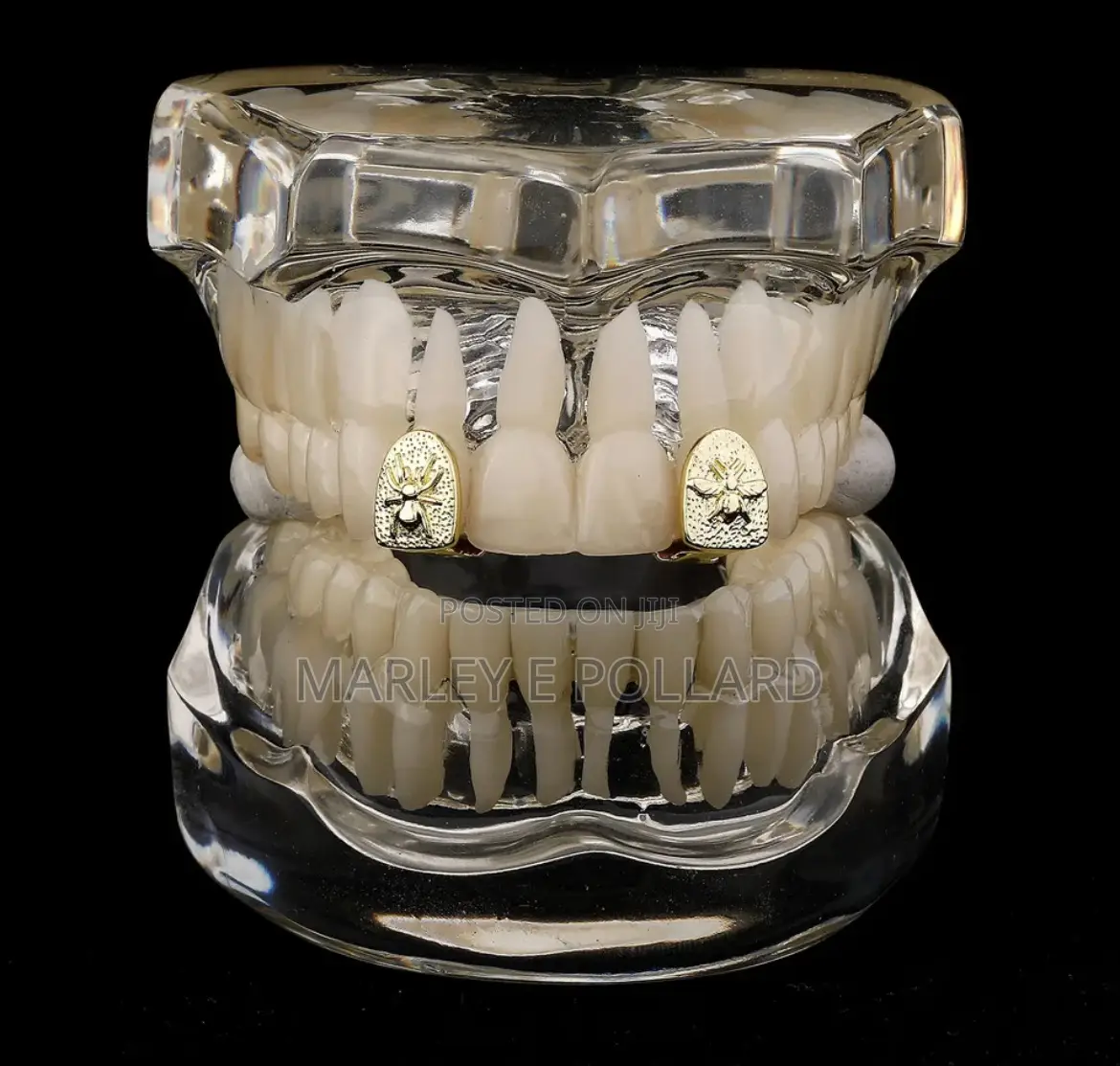 Grandeúr Luxury 14karat Gold Plated Teeth Tooth Grillz in Ikeja ...