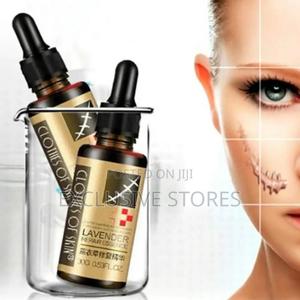 Lavender Repair Essential Oil in Lagos Island (Eko) - Bath & Body ...