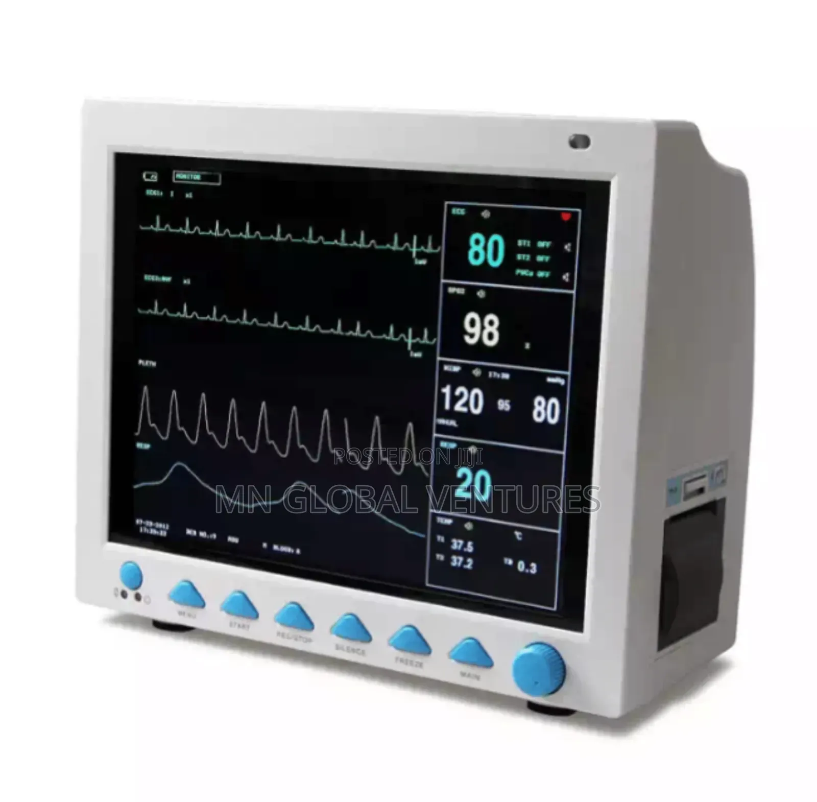 Patient Monitor in Gbagada - Medical Equipment & Supplies, Mn Global ...