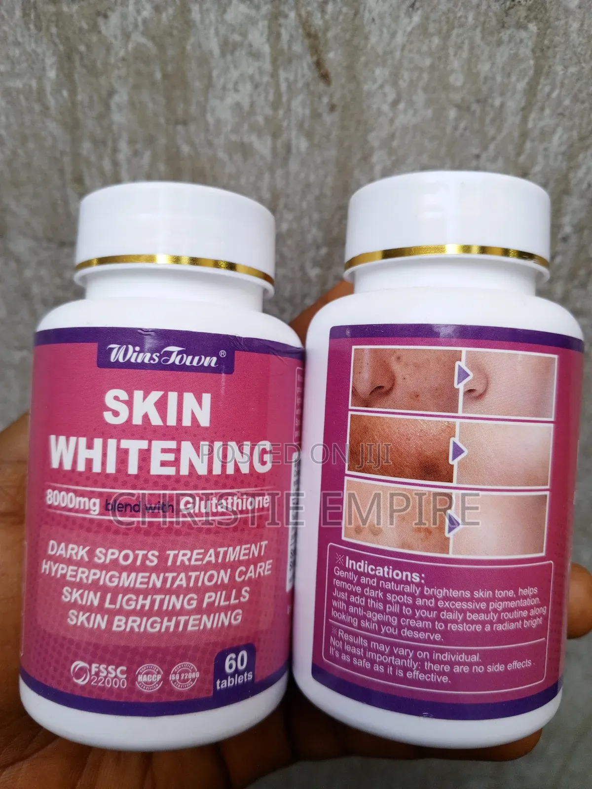 Wins Town Skin Whitening in Surulere - Vitamins & Supplements, Christie ...