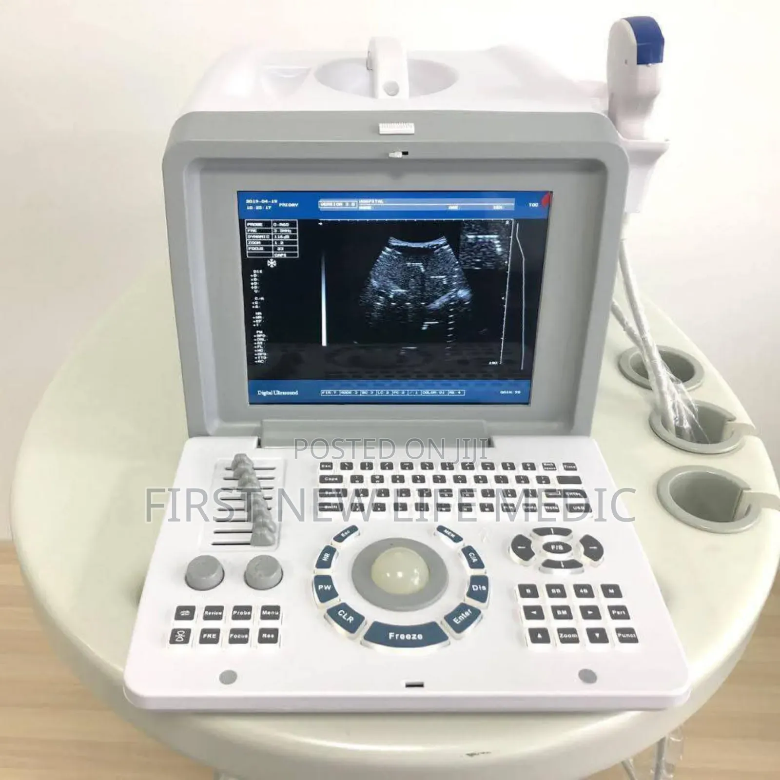 Table Top Ultrasound Scanning Machine 2d With Convex Probe in Ikeja ...