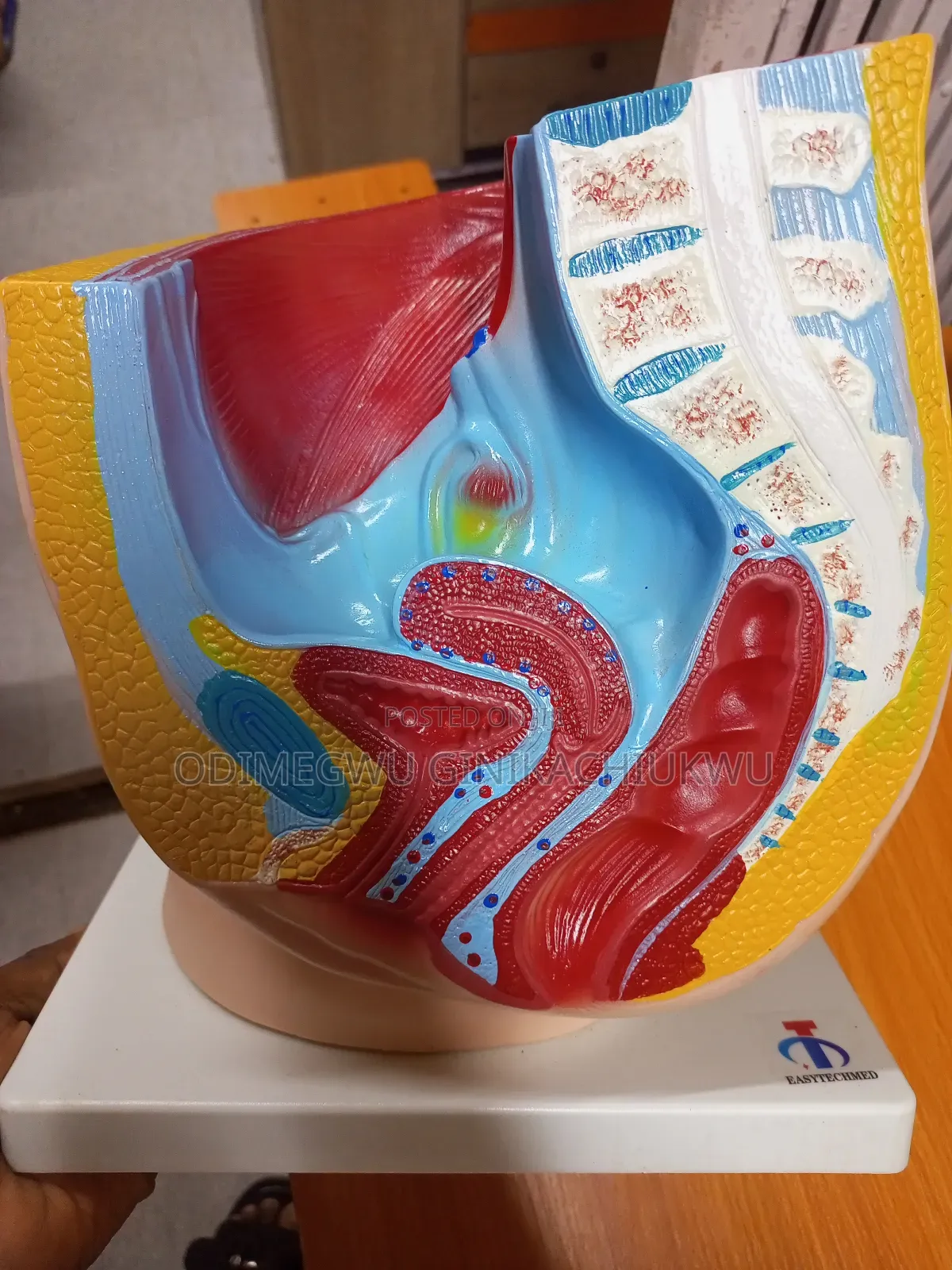 Female Pelvis Section 1 - Female Reproductive System in Lagos Island ...