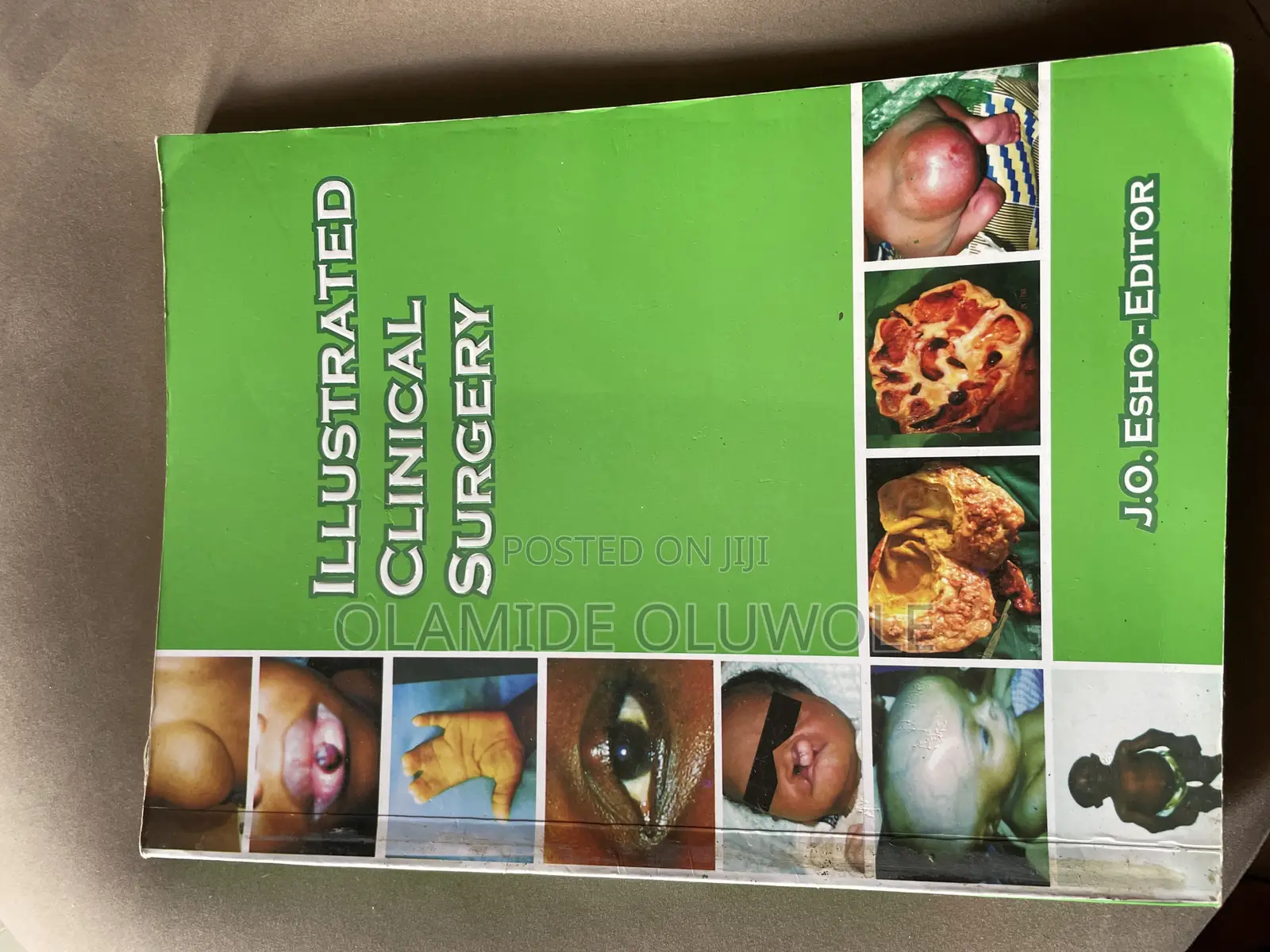 Illustrated Clinical Surgery by J.O. Esho in Ikorodu - Books & Table ...