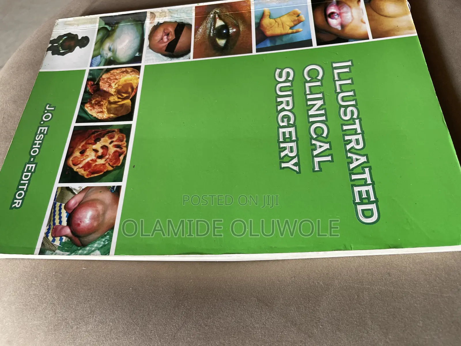 Illustrated Clinical Surgery by J.O. Esho in Ikorodu - Books & Table ...
