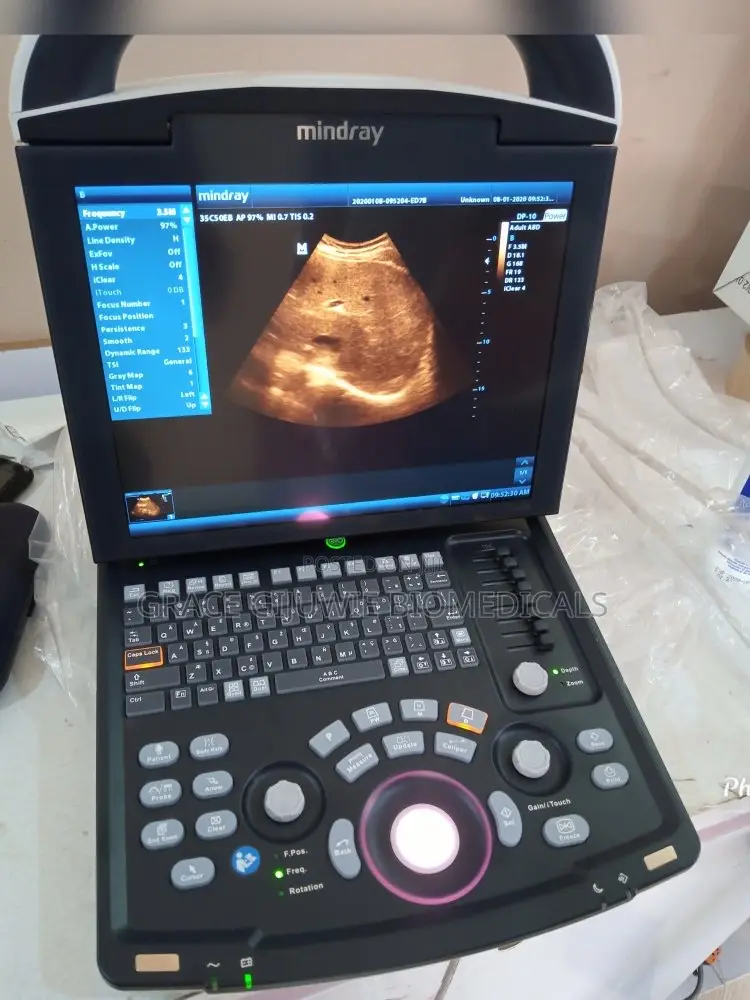 Mindray Dp10 in Ejigbo - Medical Equipment & Supplies, Grace Usang ...
