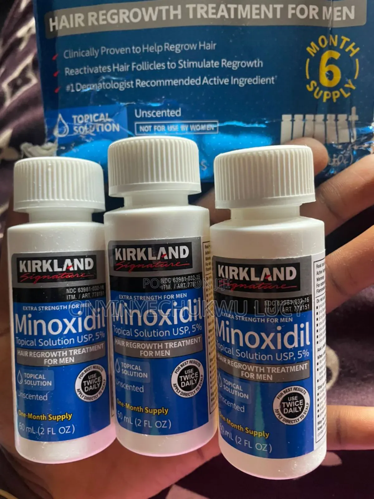 Kirkland Minoxidil (5% Off) in Ikeja - Hair Beauty, Onyinyechukwu Lucy ...