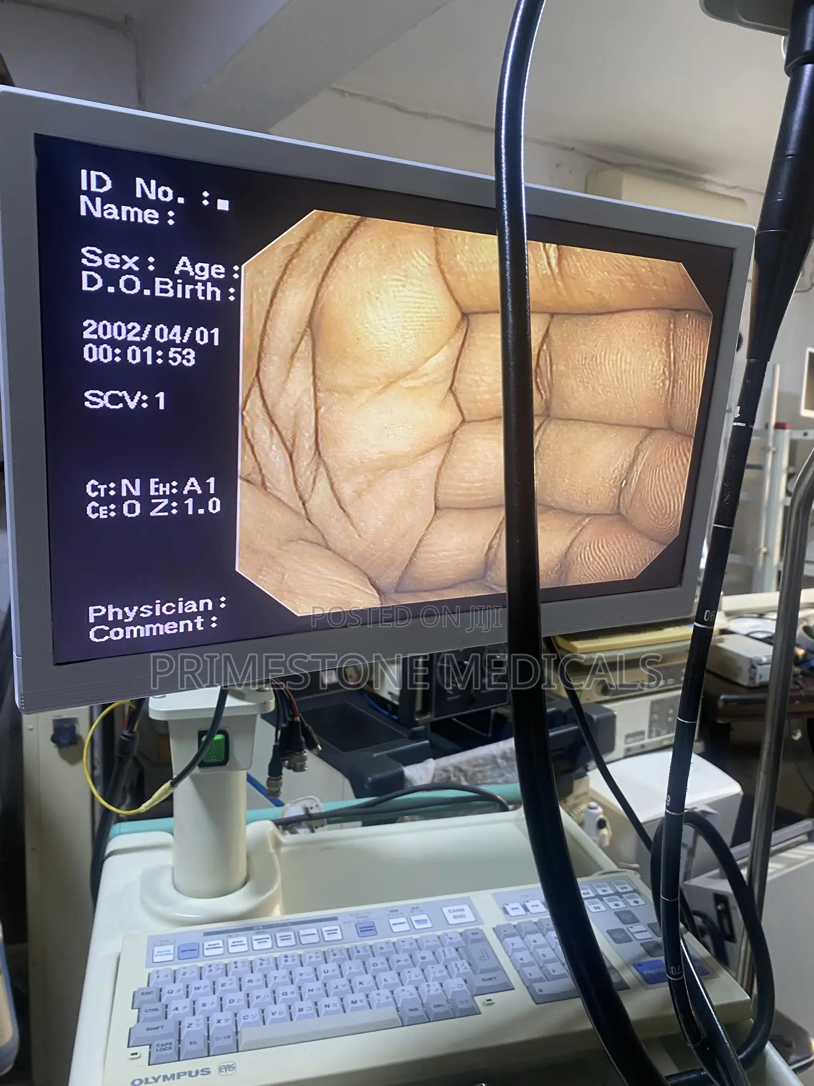 Endoscopy System in Ikeja - Medical Equipment & Supplies, Primestone ...