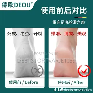 Foot Grinder Pedicure Tool Callous Remover in Ikeja - Tools ...