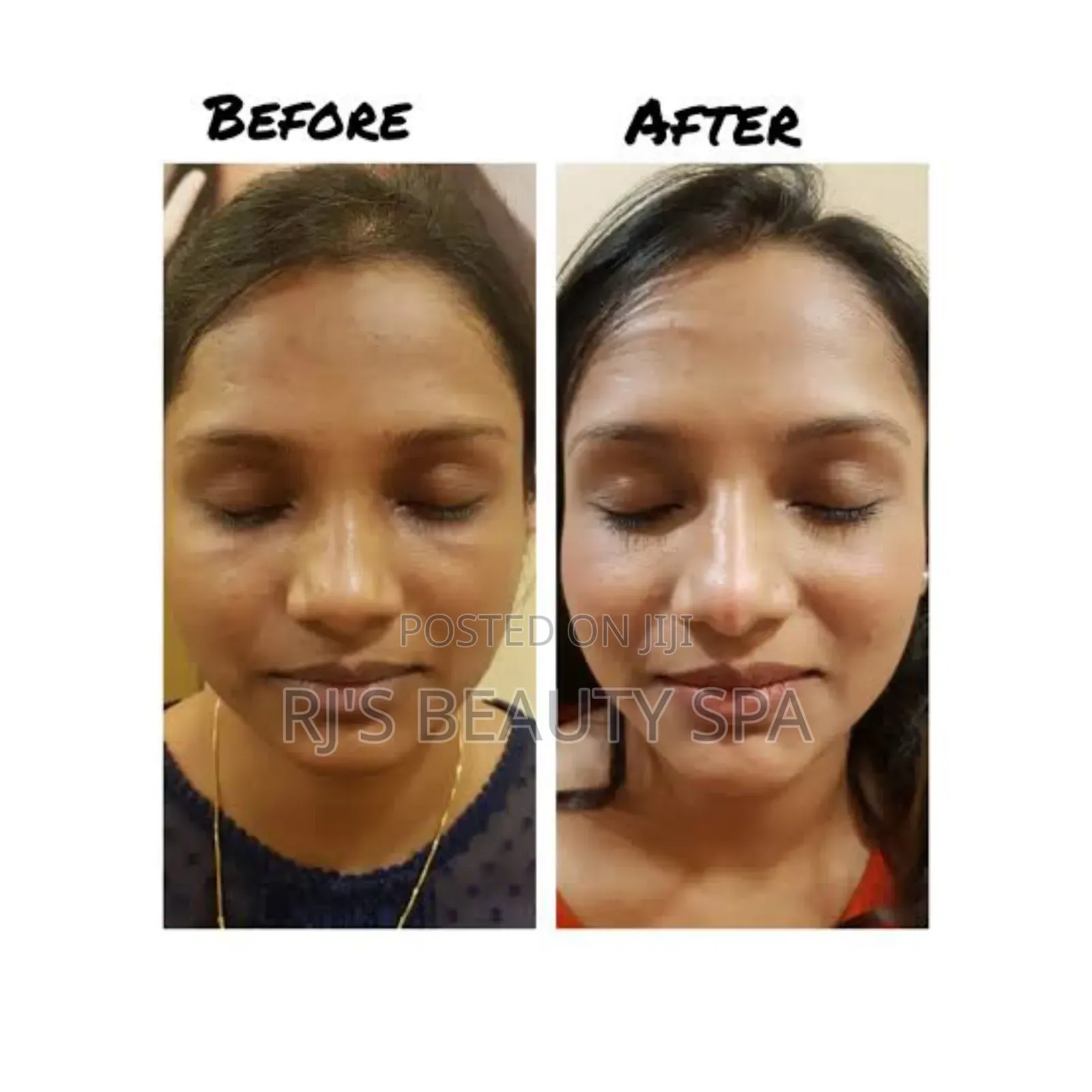 Iv Drip Skin Whitening in Gwarinpa - Health & Beauty Services, Rejoice ...