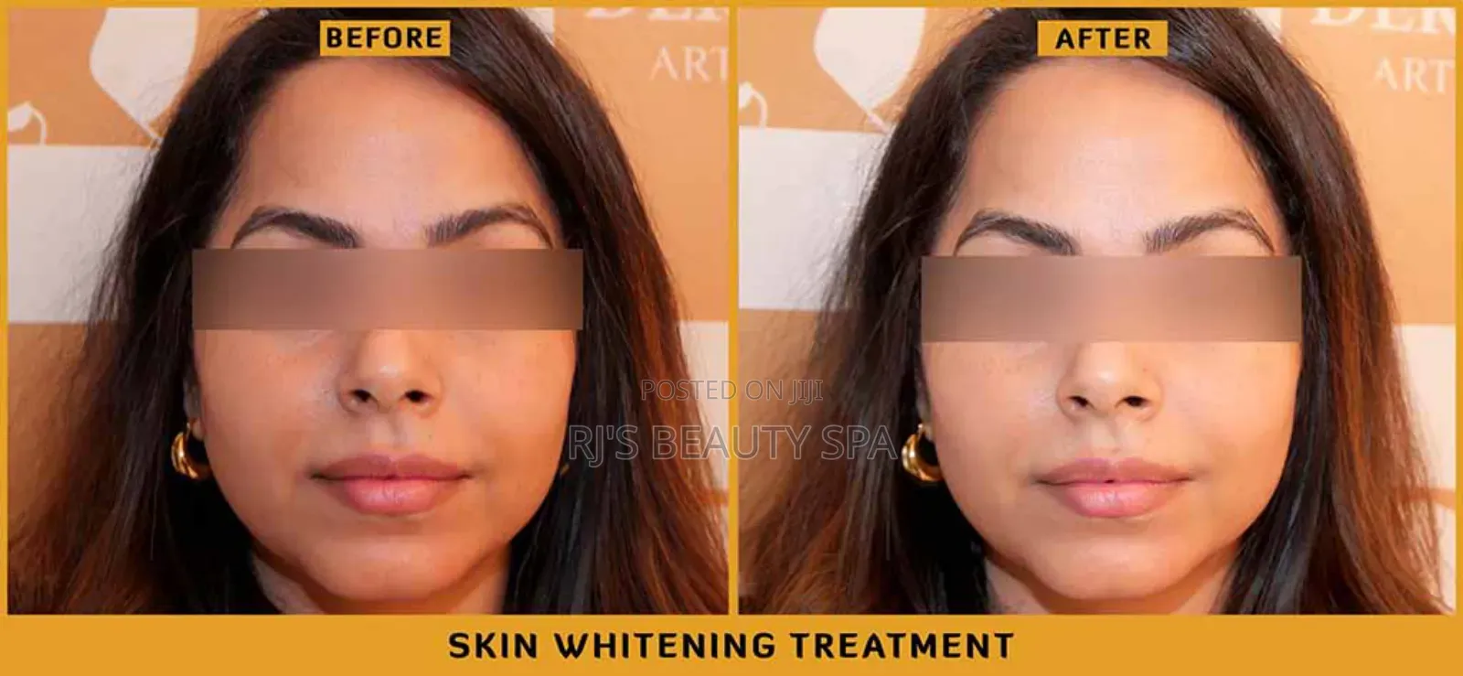 Iv Drip Skin Whitening in Gwarinpa - Health & Beauty Services, Rejoice ...